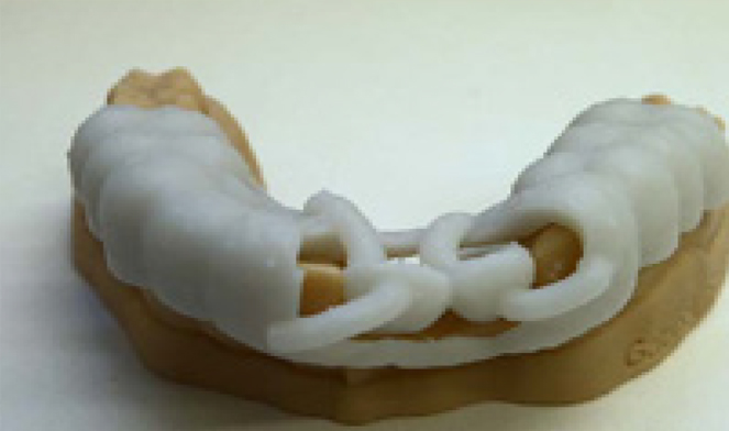 The Dual-Guide Technique