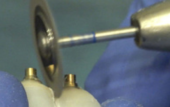 The Dual-Guide Technique